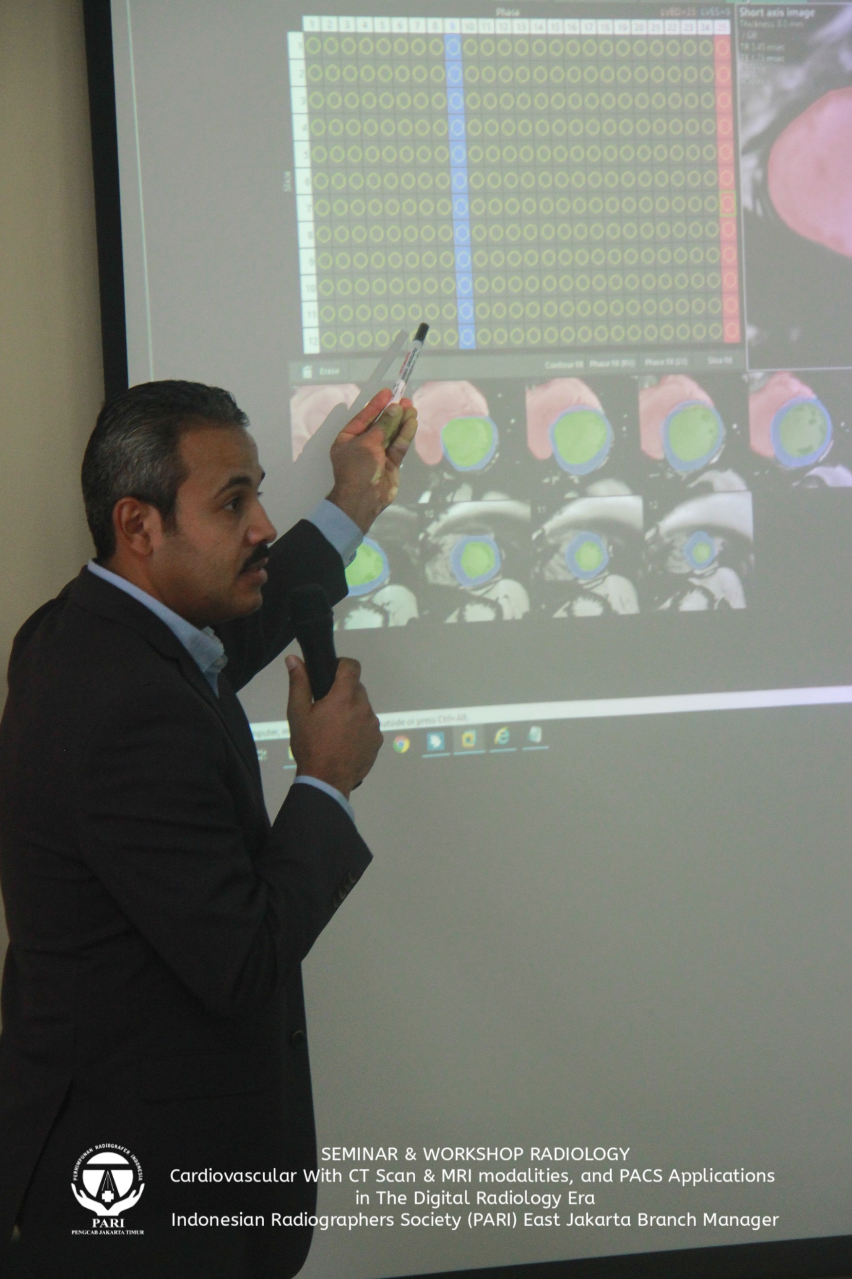 Seminar dan Workshop Cardiovascular dengan Modalitas CT Scan, MRI serta ...